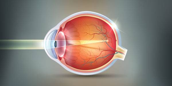 Laser Eye Surgery for Myopia: Procedure and Benefits